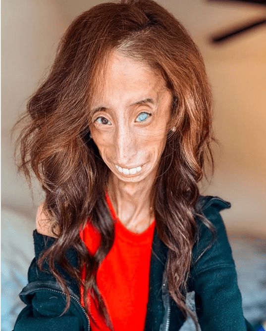 De víctima a inspiración: Lizzie Velásquez y su poderosa lección a los ...